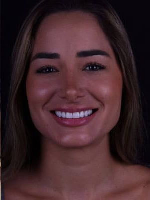 Bruna - Carlsbad Beach Dental
