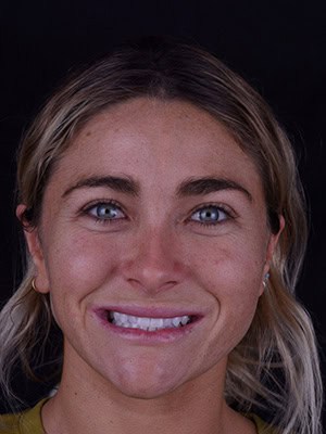 Carlsbad Smile Gallery - Drew Addy, DDS - Carlsbad Beach Dental